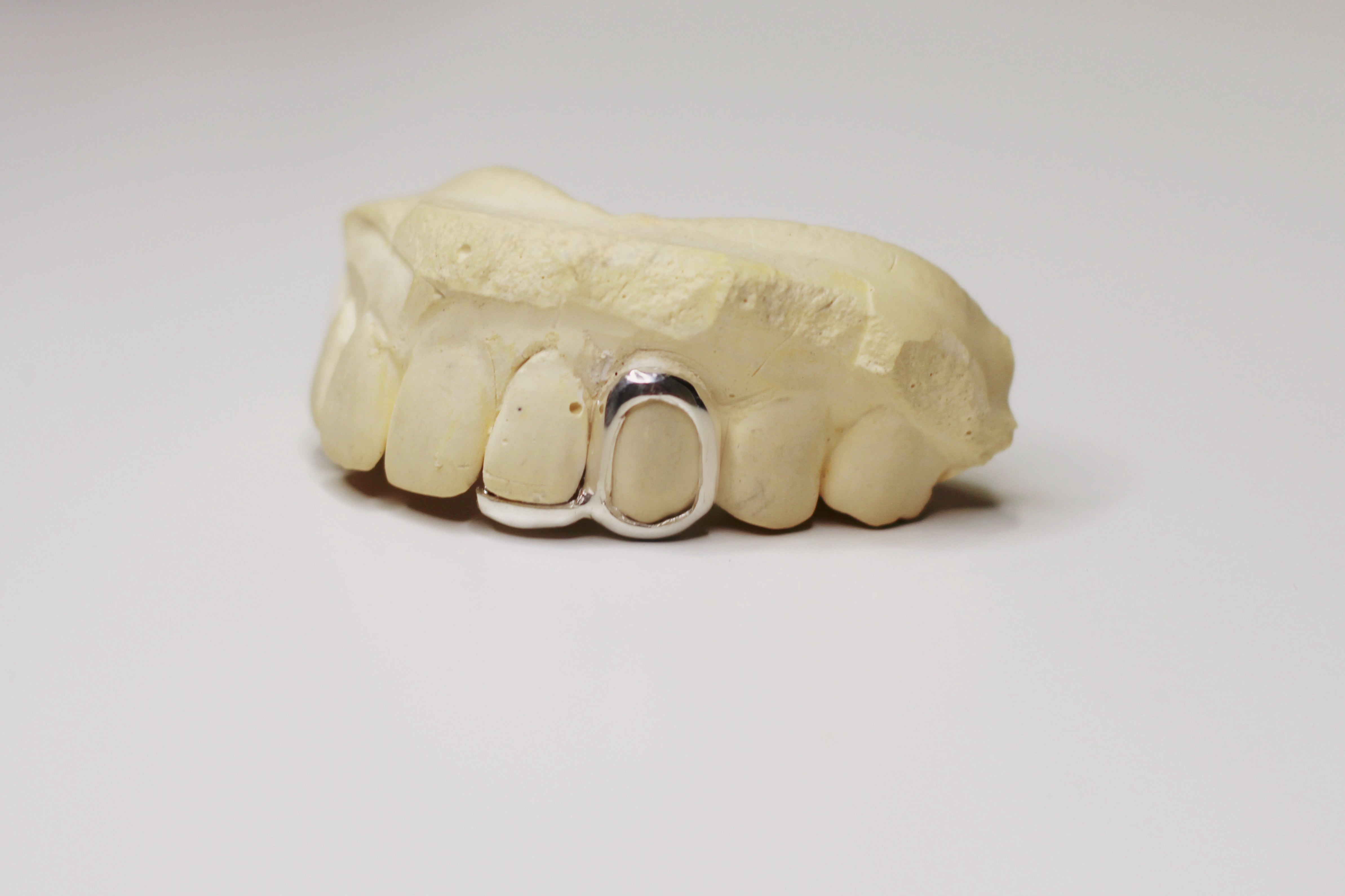 Grillz – kon.sen.suss