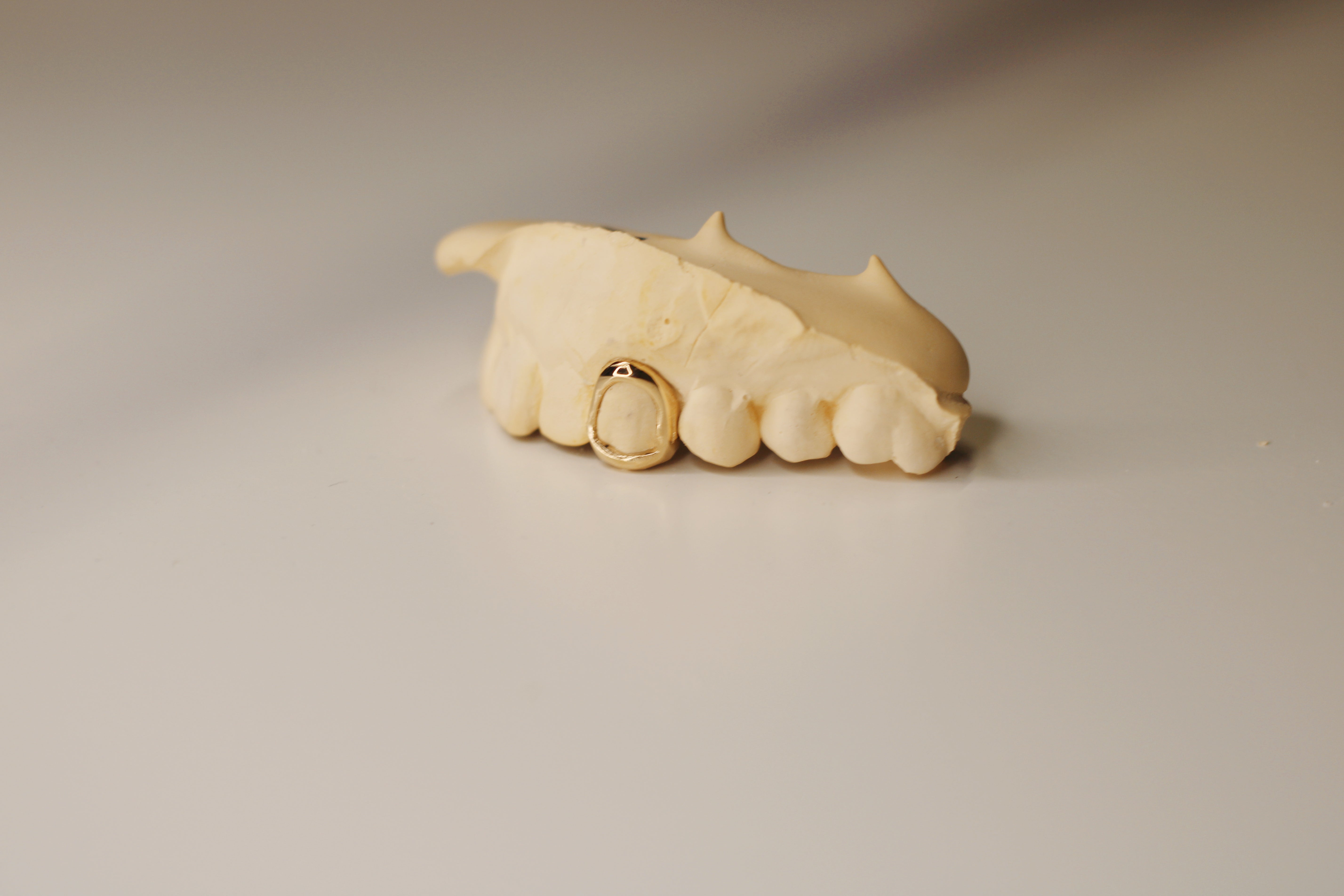 Grillz – kon.sen.suss