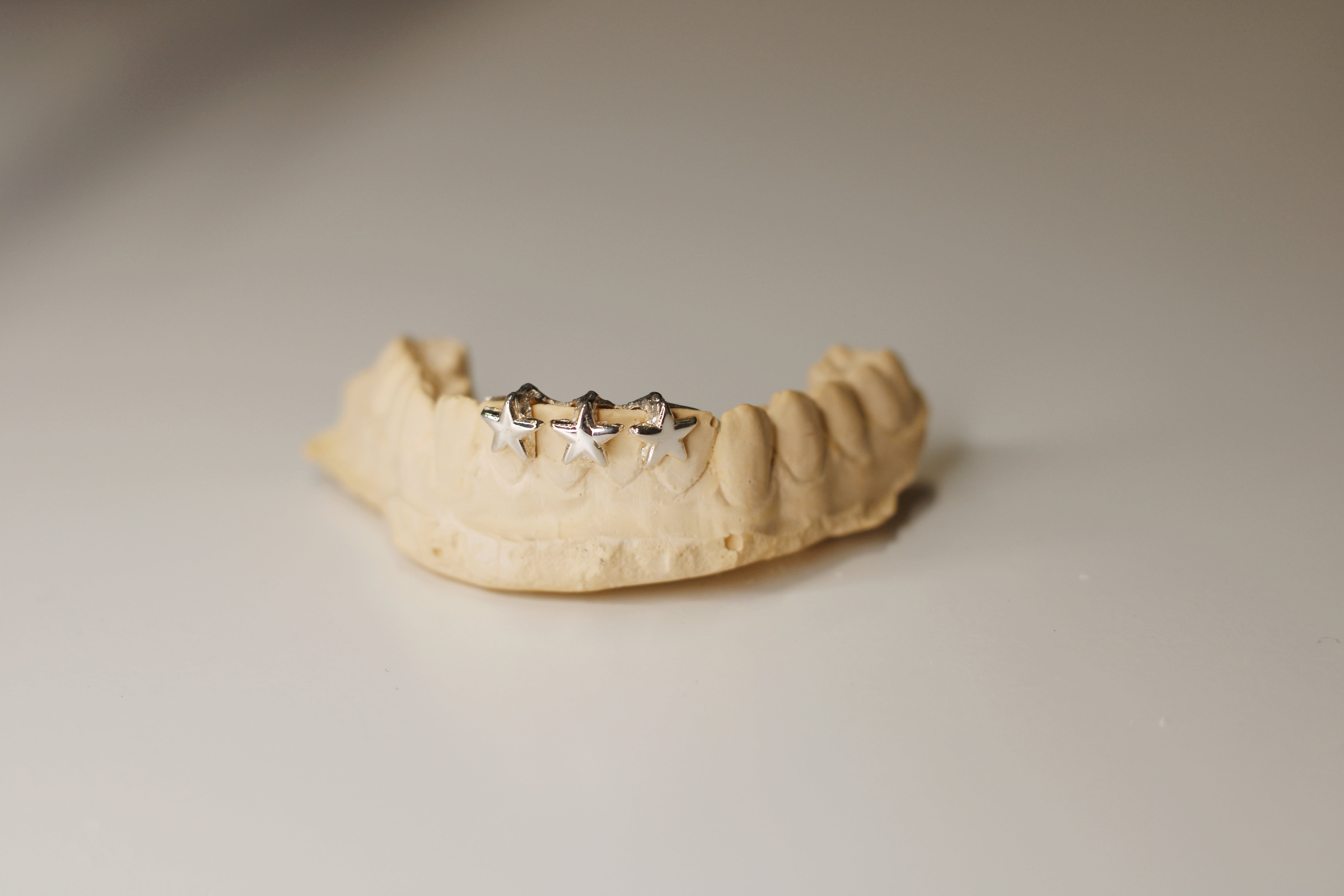 Grillz – kon.sen.suss